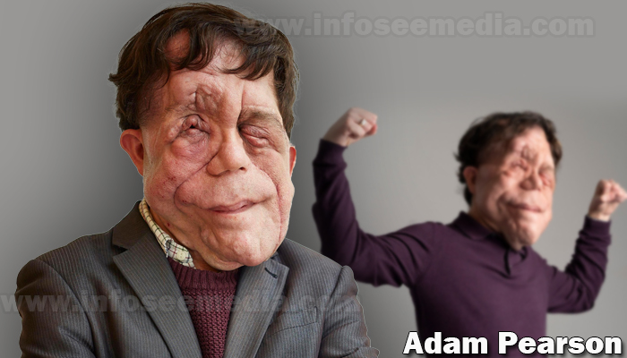 Adam Pearson: Bio, family, net worth | Celebrities InfoSeeMedia