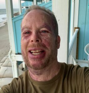 Kevin Sussman Net worth, Age, Height, Family & More [2024 ...